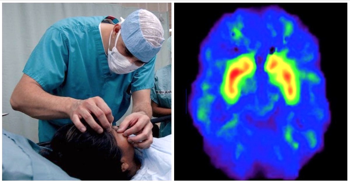 New Scientific Study Shows That The Brain Is Still Active After Death ...
